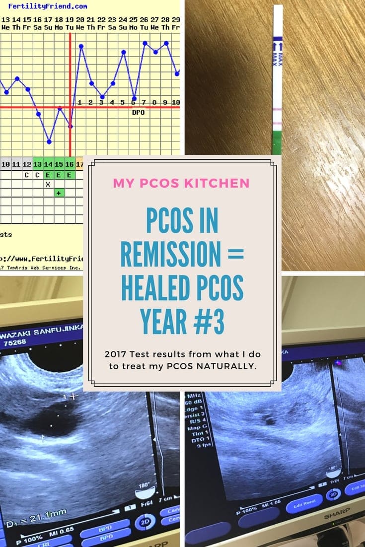 How I Cured My PCOS - Intermittent Fasting, Paleo, and Keto
