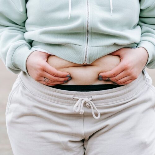 PCOS Belly Fat - How to Lose Stomach Fat with PCOS