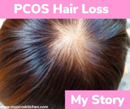 PCOS Hair Loss - My Story and What I've Learned